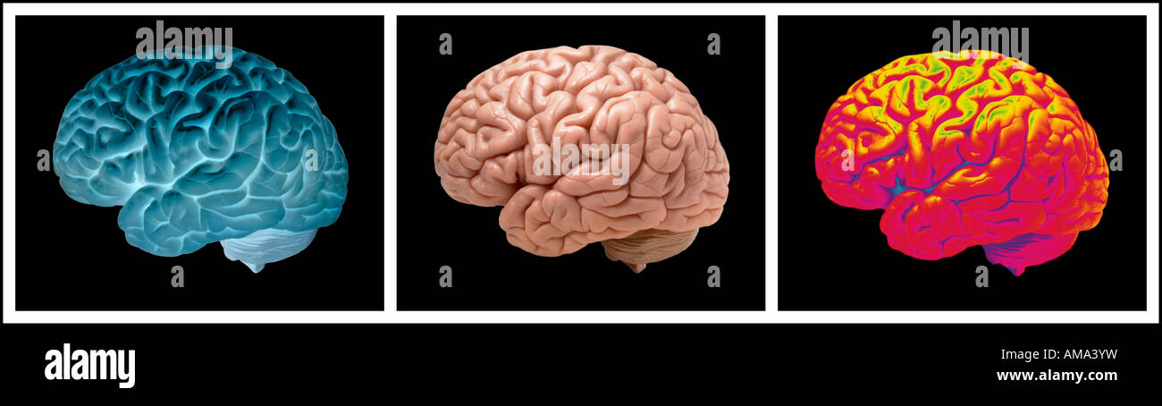Human and brain hi-res stock photography and images - Alamy