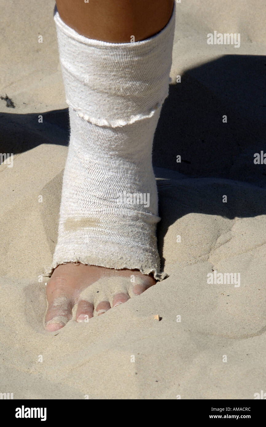 Adult female with a bandaged ankle walking on the beach Stock Photo - Alamy