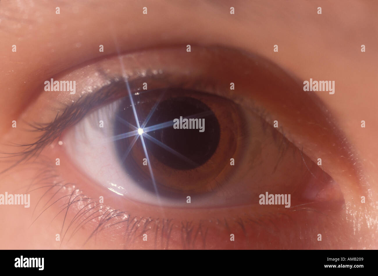 Body Eye Stock Photo - Alamy