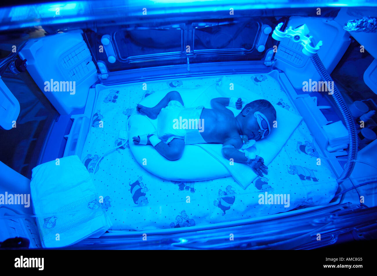 New Born premature Baby in incubator - Neonatal Intensive Care Unit ...