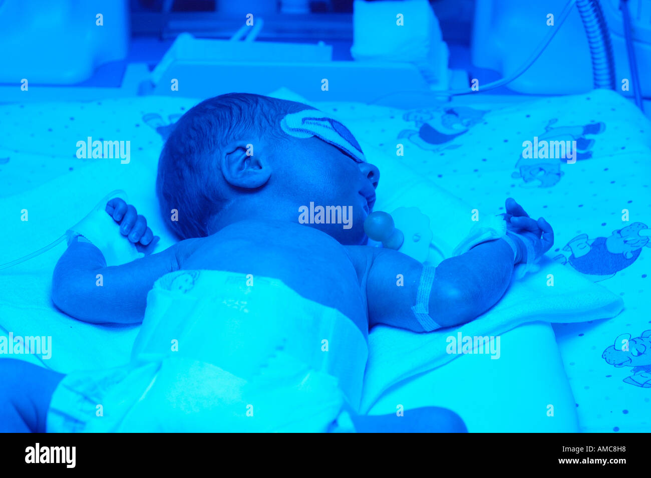 NewBorn premature Baby in incubator - Neonatal Intensive Care Unit ...