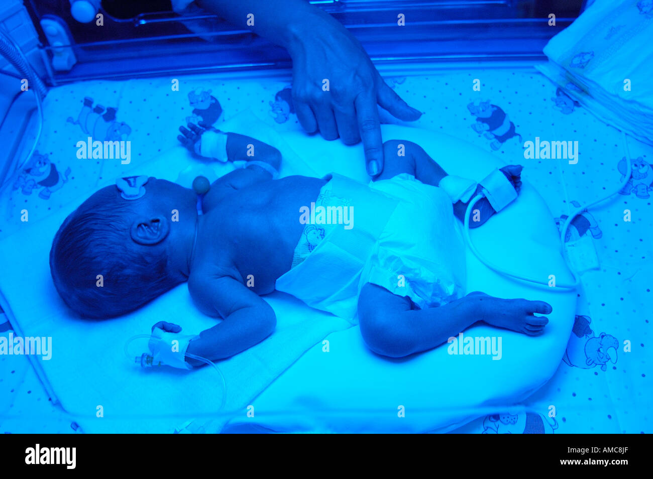 New Born premature Baby in incubator - Neonatal Intensive Care Unit ...