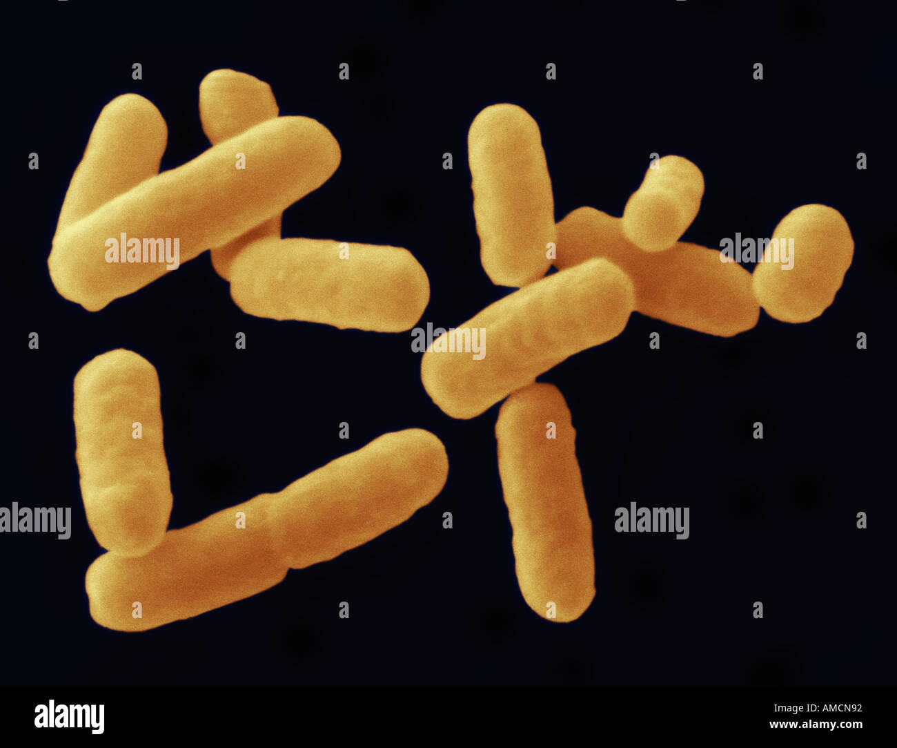 Shigella Flexneri Nitrate Test