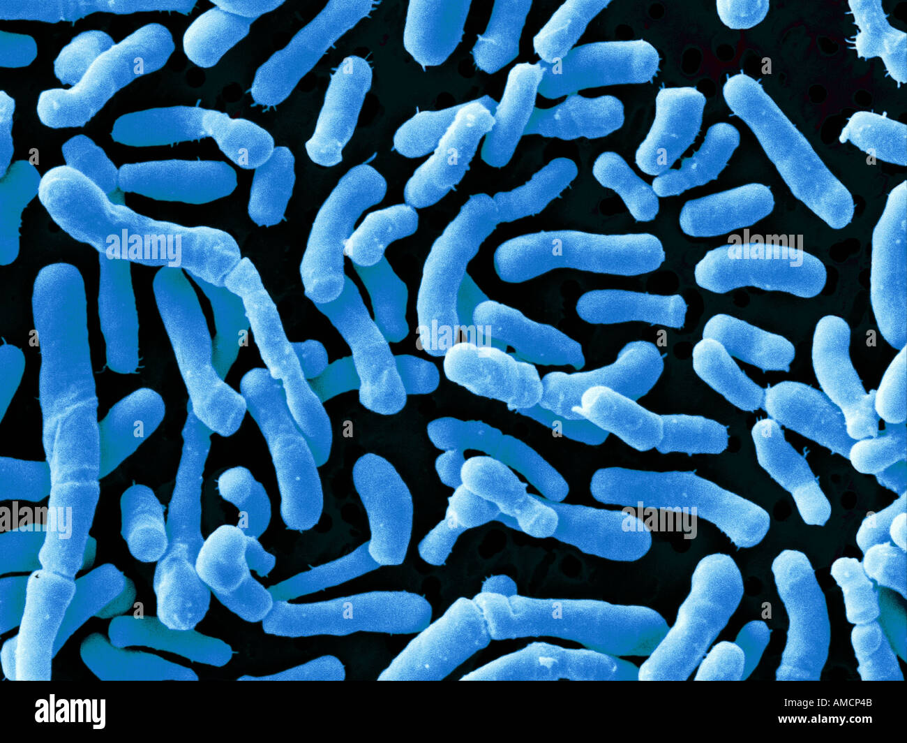 SEM - Bifidobacterium pullorum microscopic Stock Photo: 4970058 - Alamy SEM - Bifidobacterium pullorum microscopic Stock Photo: 4970058 - Alamy