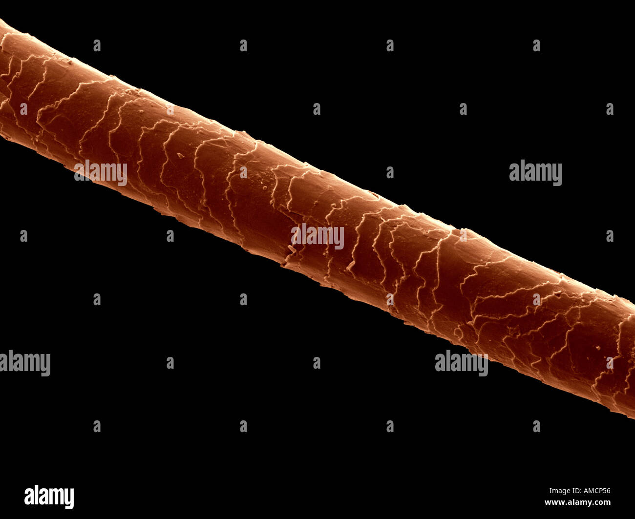 Keratin micrograph hi-res stock photography and images - Alamy