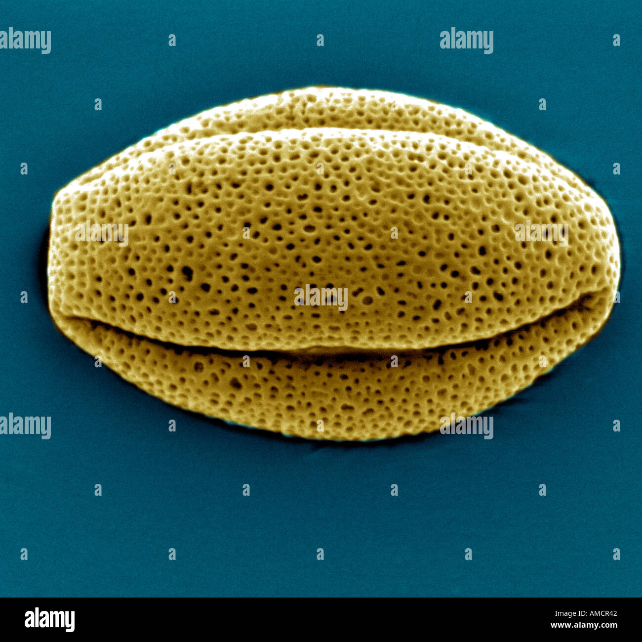 SEM x2400 - crown of thorns pollen Stock Photo - Alamy