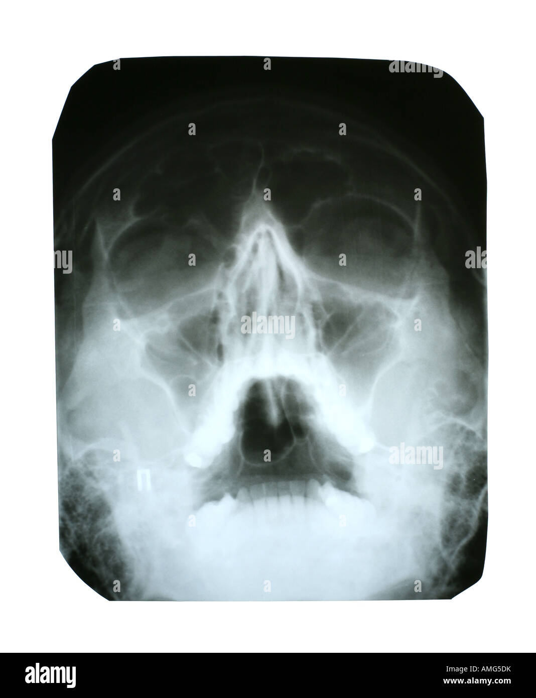 X Ray Head