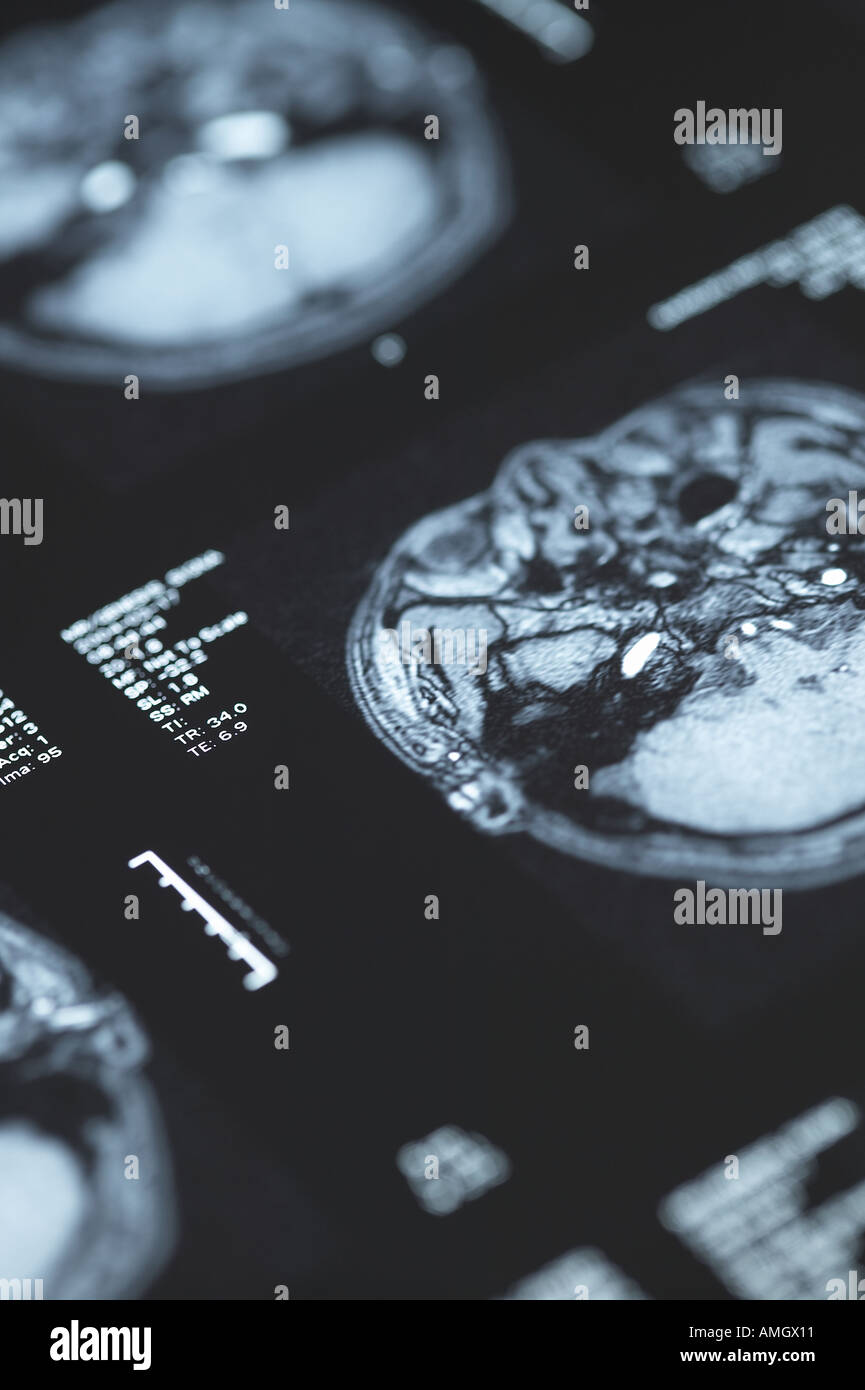 Medical photograph hi-res stock photography and images - Alamy