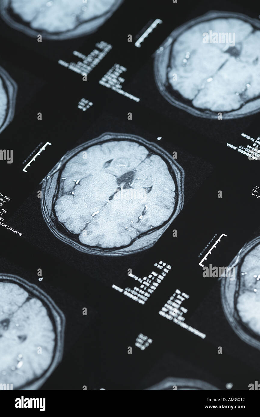 Medical photograph hi-res stock photography and images - Alamy