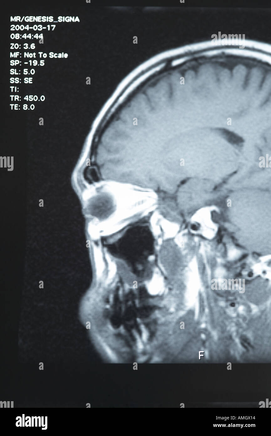 Human organs photographs hi-res stock photography and images - Alamy