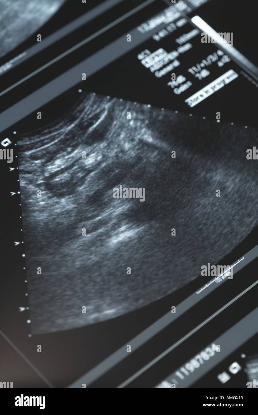 Medical photograph hi-res stock photography and images - Alamy