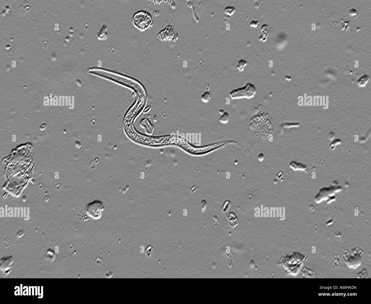 Roundworm hi-res stock photography and images - Alamy