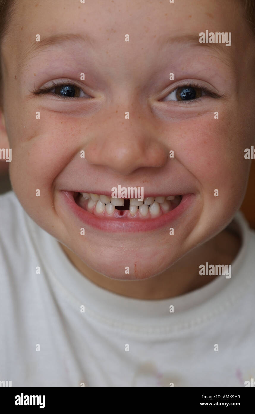 Seven year old boys smiles showing missing front tooth Stock Photo - Alamy