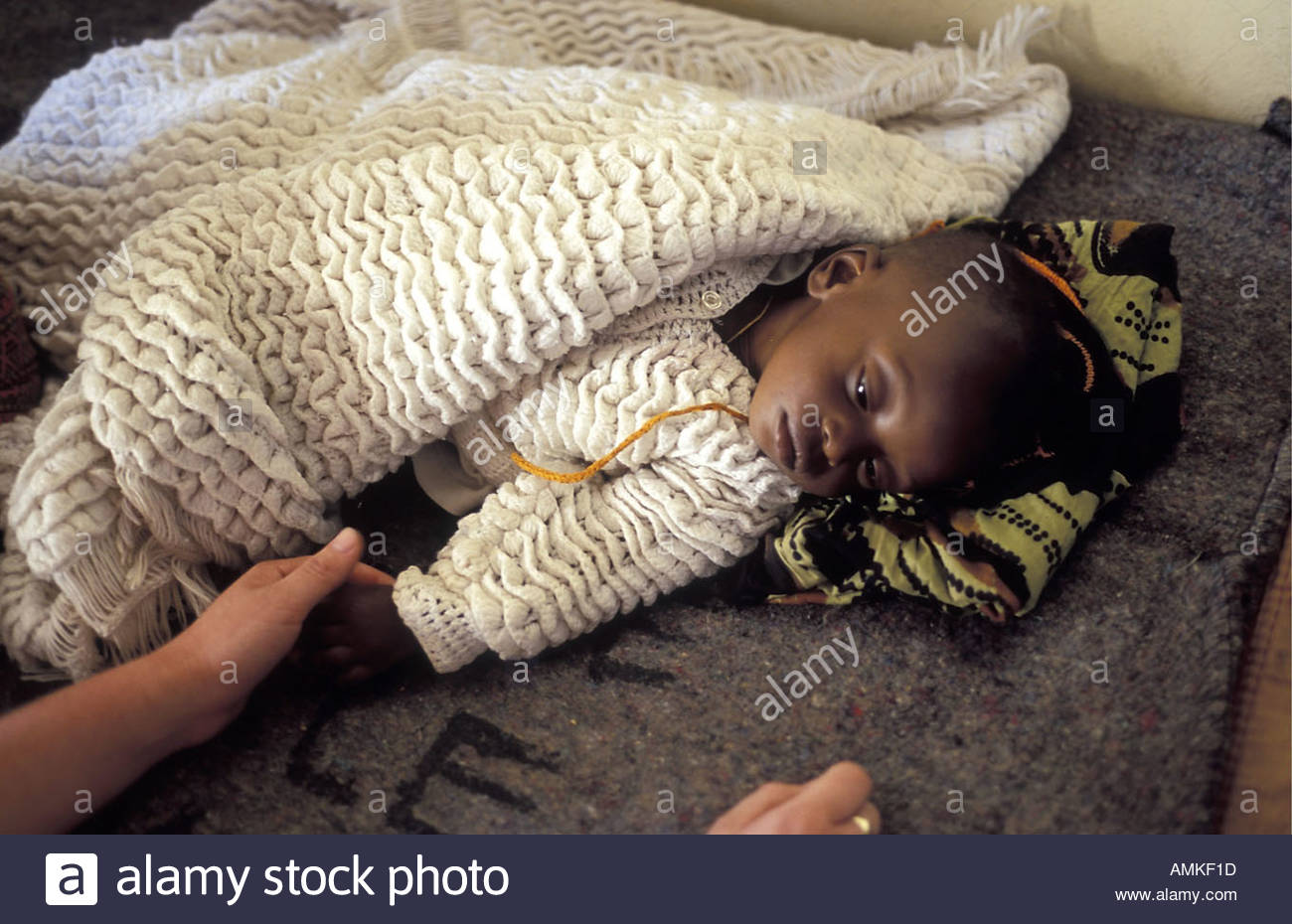 Sick child with AIDS at the Nkole Health Centre Zambia Africa Nikos ...