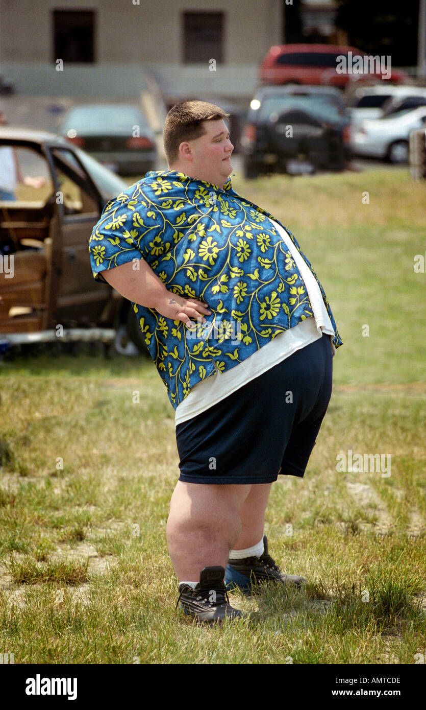 Starving condition hi-res stock photography and images - Alamy