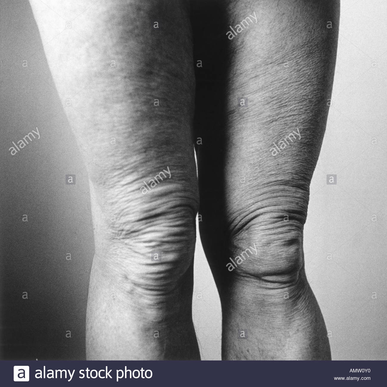 Wrinkles Wrinkly Black and White Stock Photos & Images - Alamy