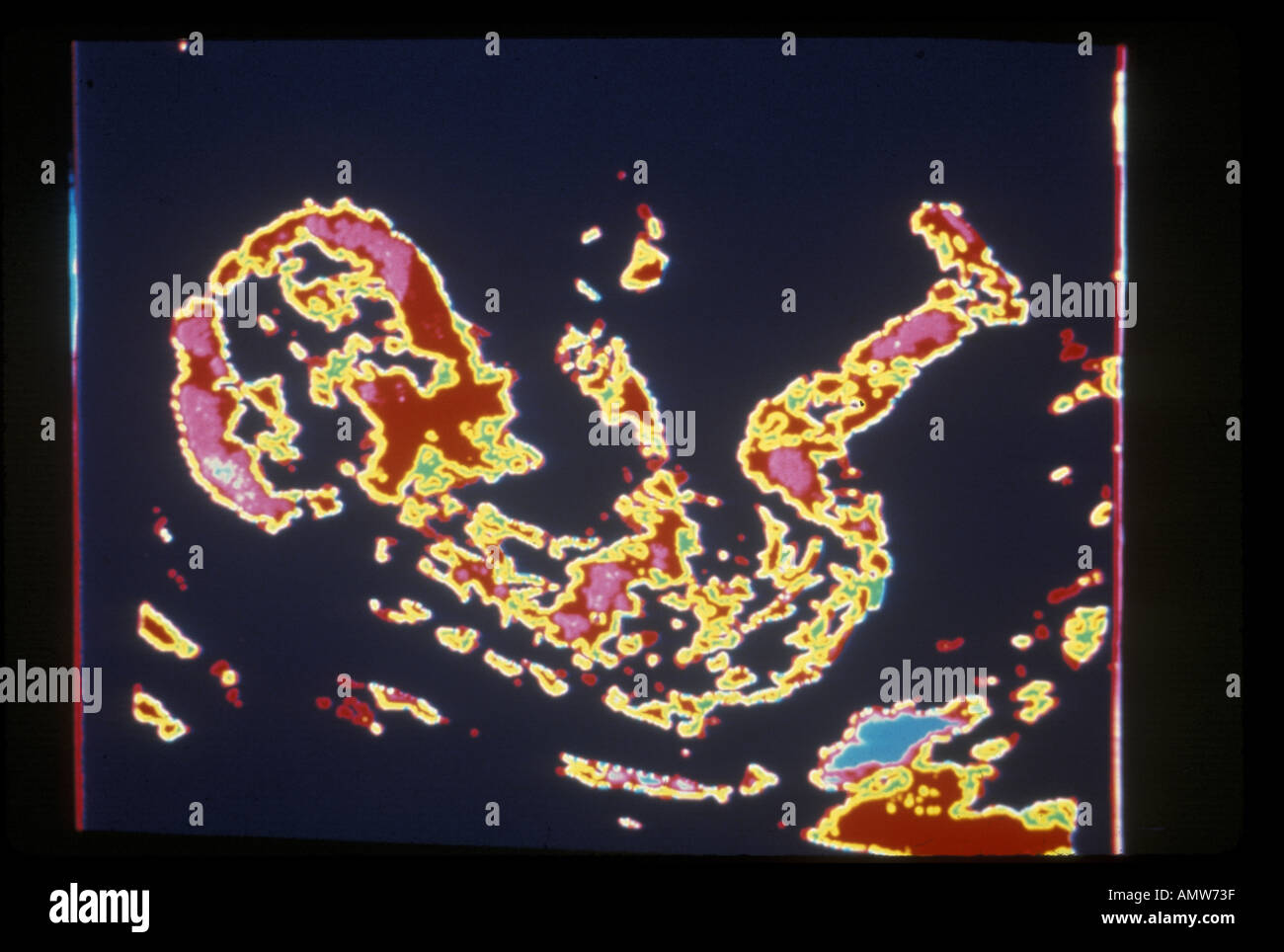 Childbirth fetus Ultra sound scan of a 30 weeks fetus Stock Photo - Alamy