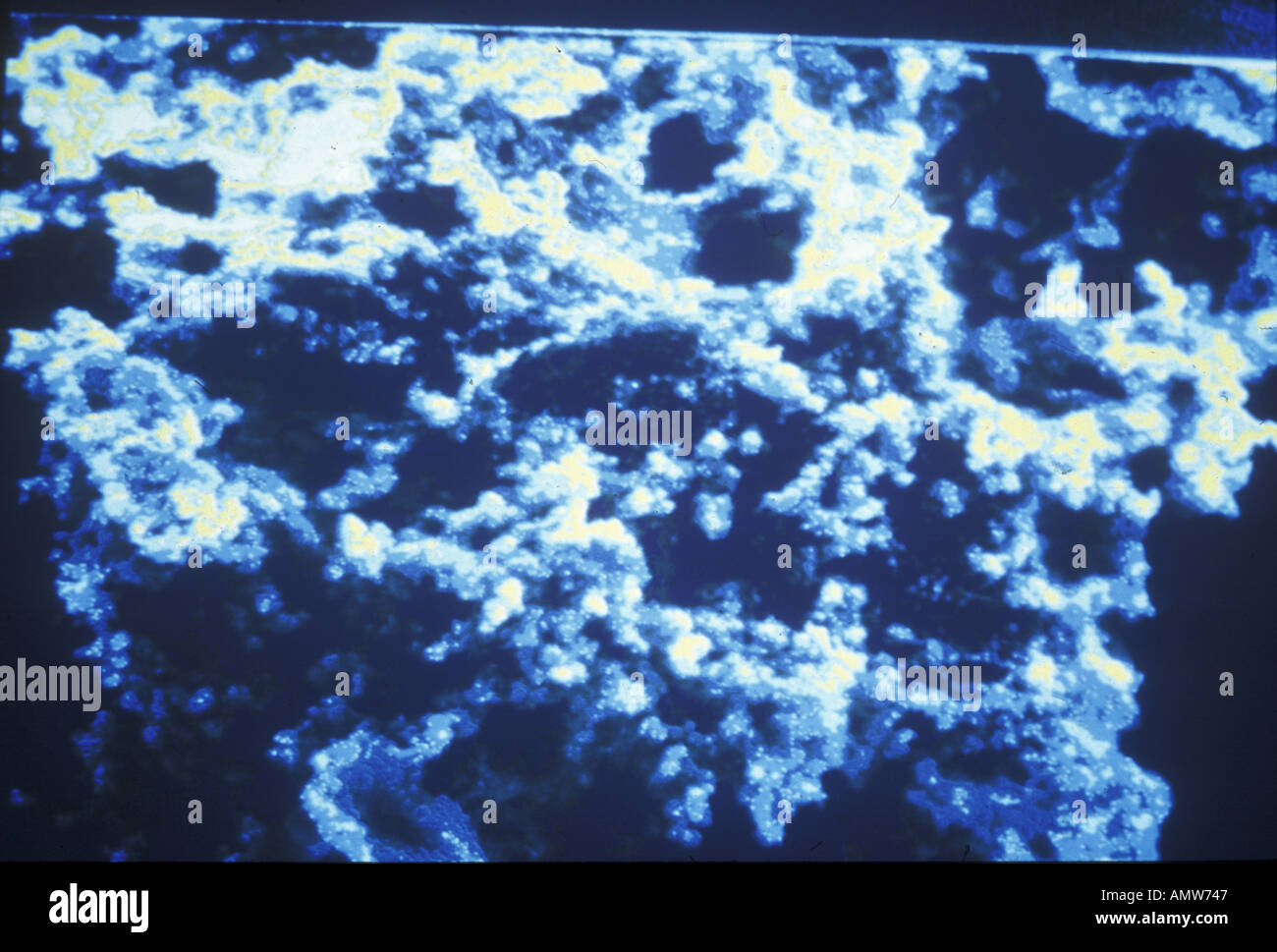 Lipids micro Stock Photo - Alamy