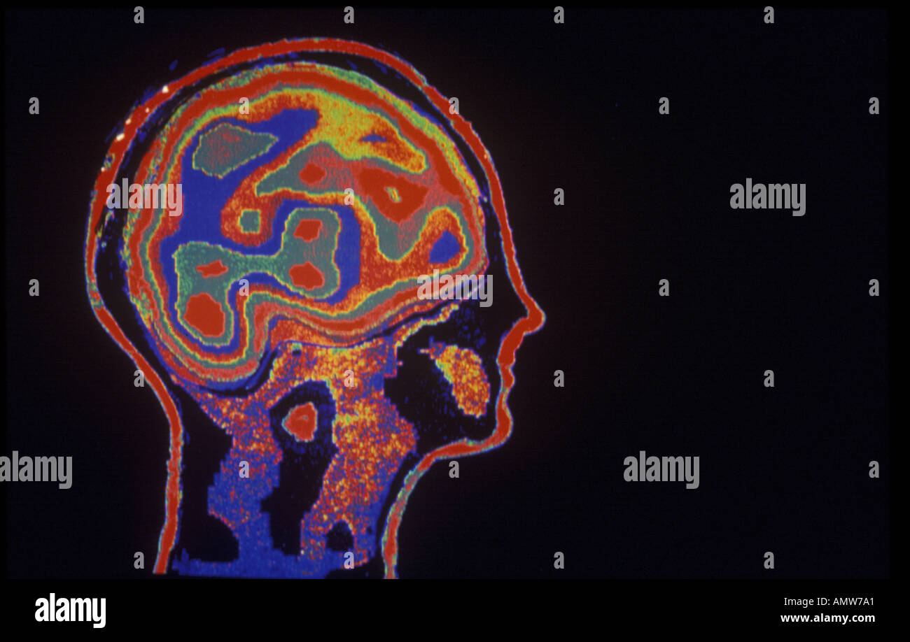 Pet Scan Stock Photo - Alamy