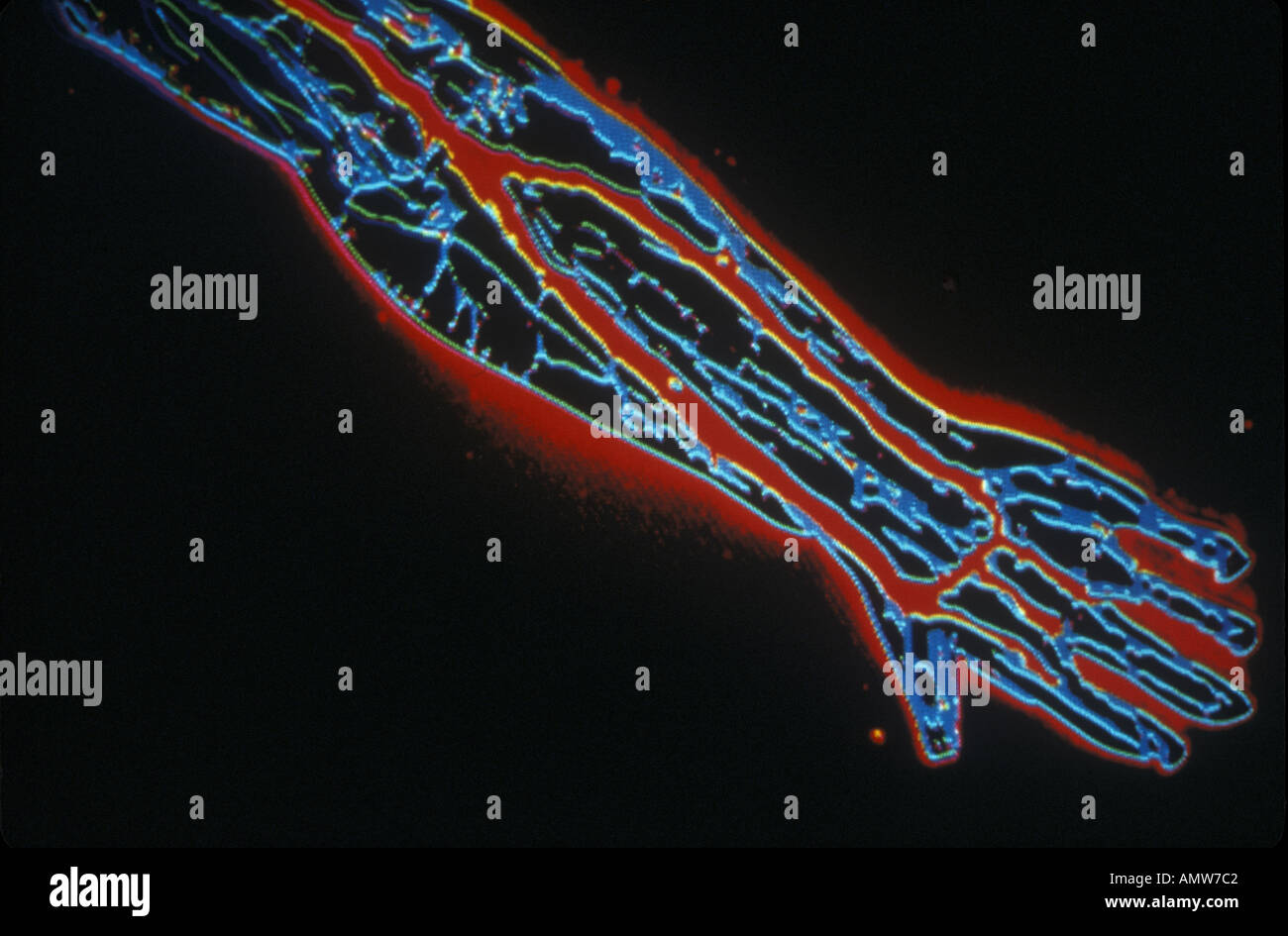 Blood vessels Arm Stock Photo - Alamy
