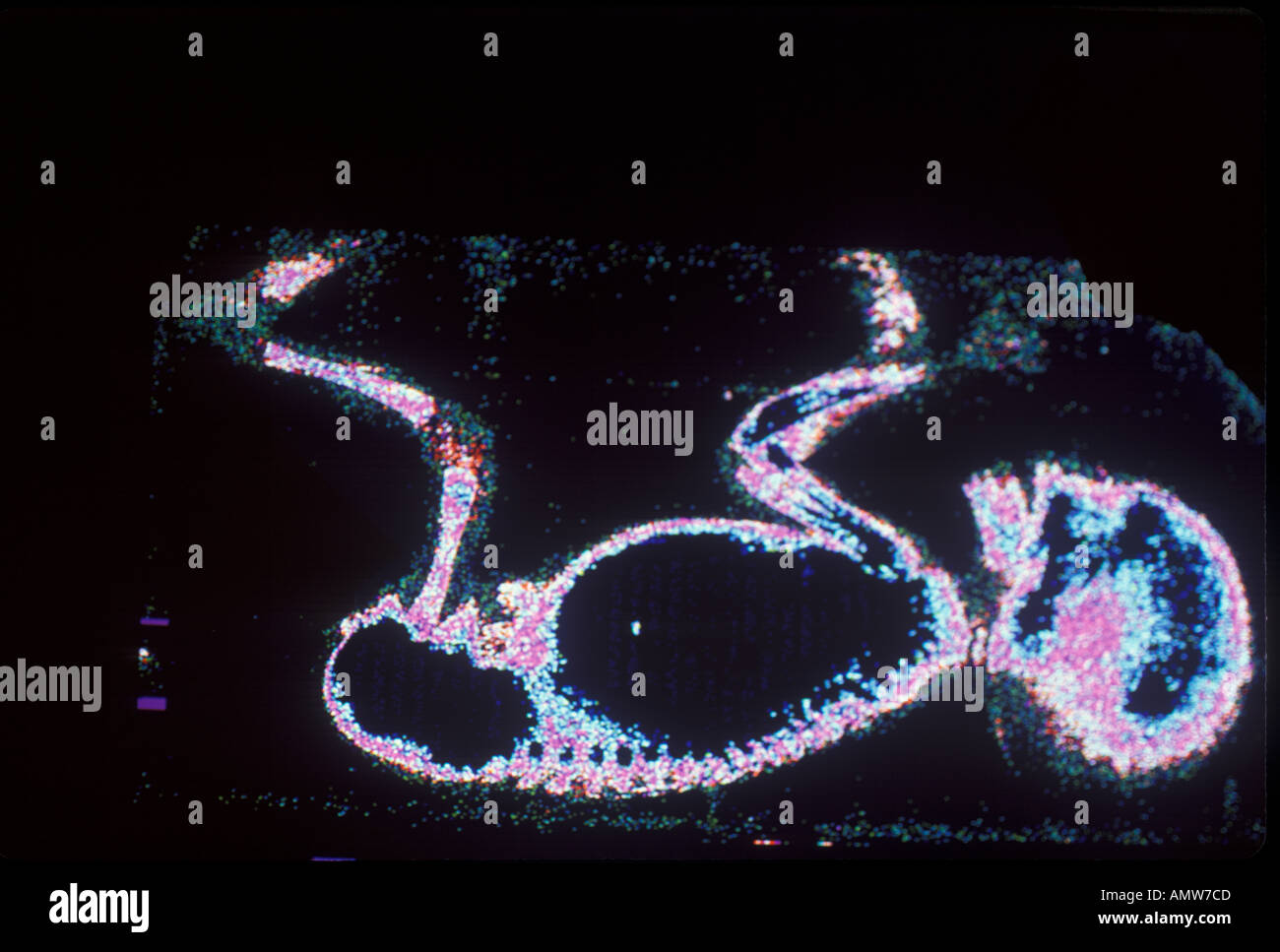 Fetus Ultrasound 22 weeks Stock Photo - Alamy