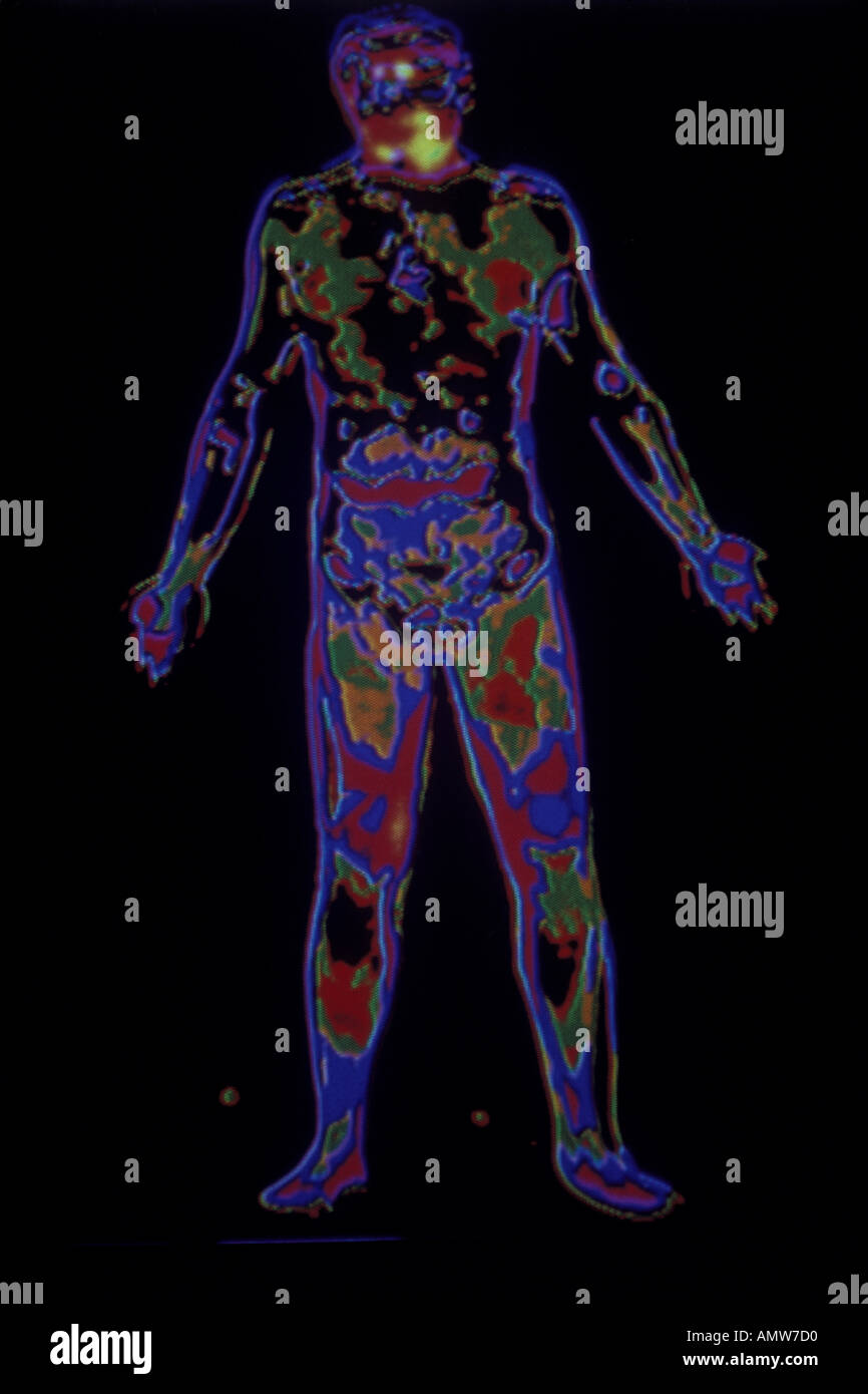 Mri normal hi-res stock photography and images - Alamy