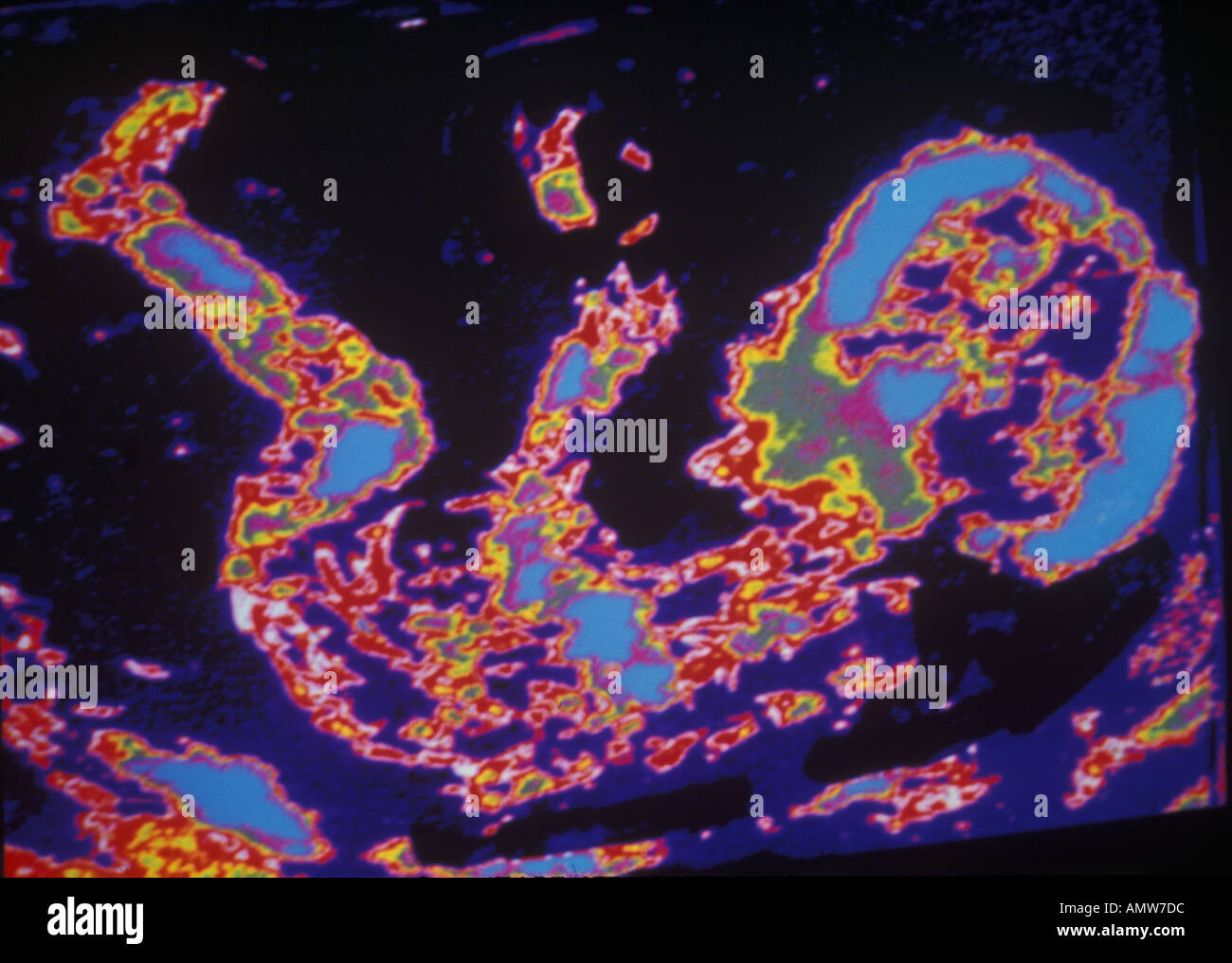 Side view of fetus 9 weeks Stock Photo - Alamy