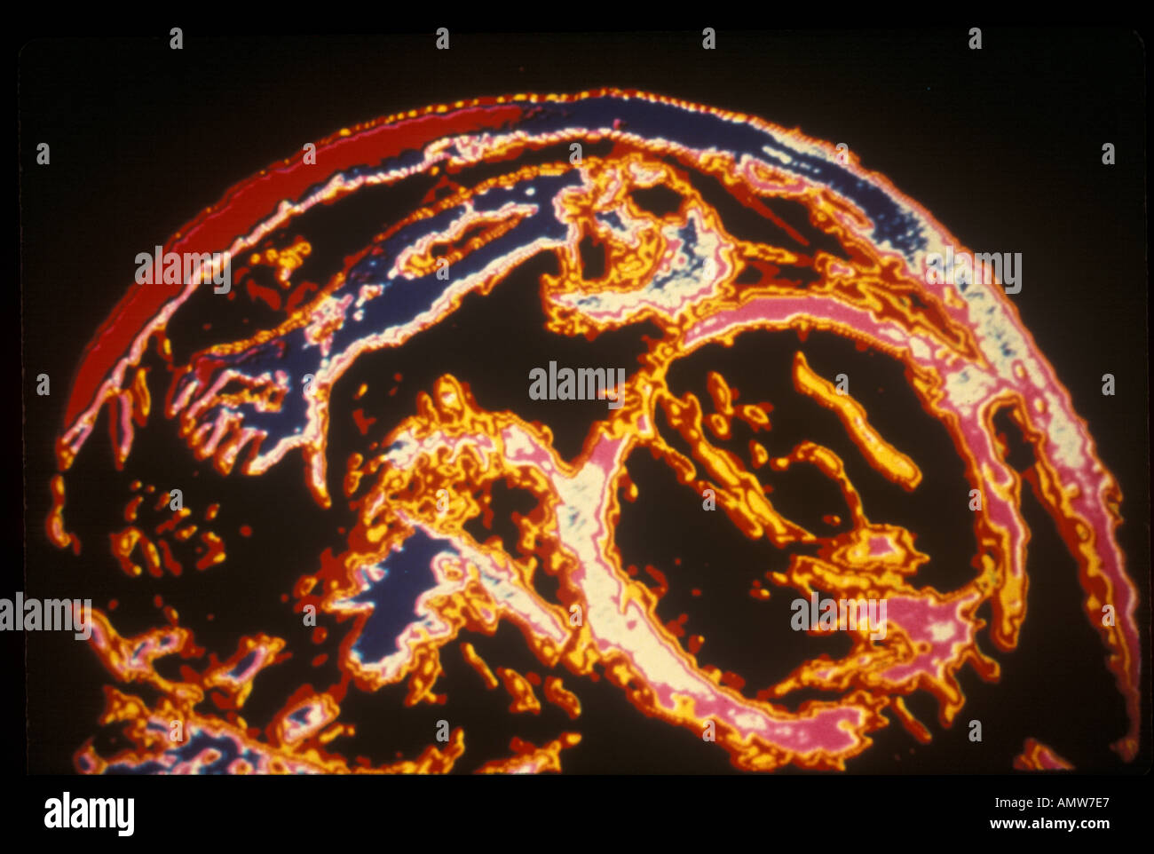 20 week Fetus Stock Photo - Alamy