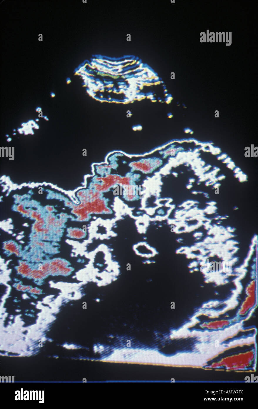 Fetus 28 weeks Stock Photo - Alamy