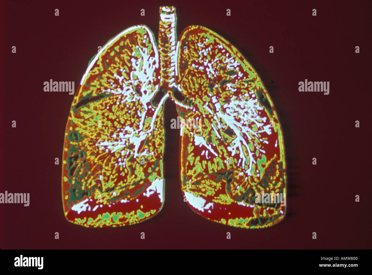 Normal lungs hi-res stock photography and images - Alamy