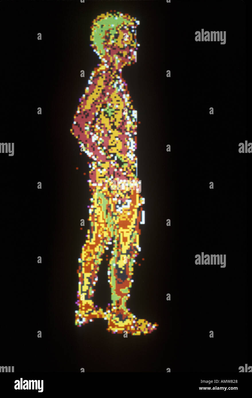 Nornal color x ray male Stock Photo - Alamy