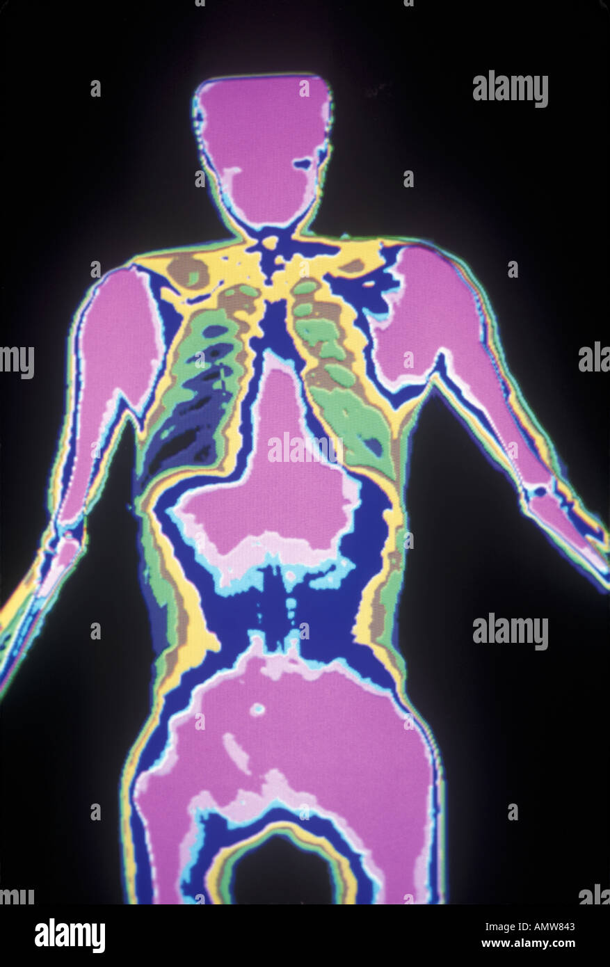 Nuclear scan X ray Stock Photo - Alamy