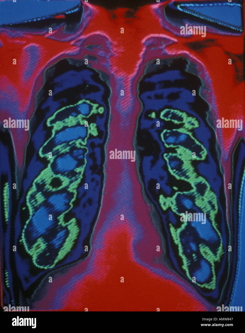 Mri normal hi-res stock photography and images - Alamy