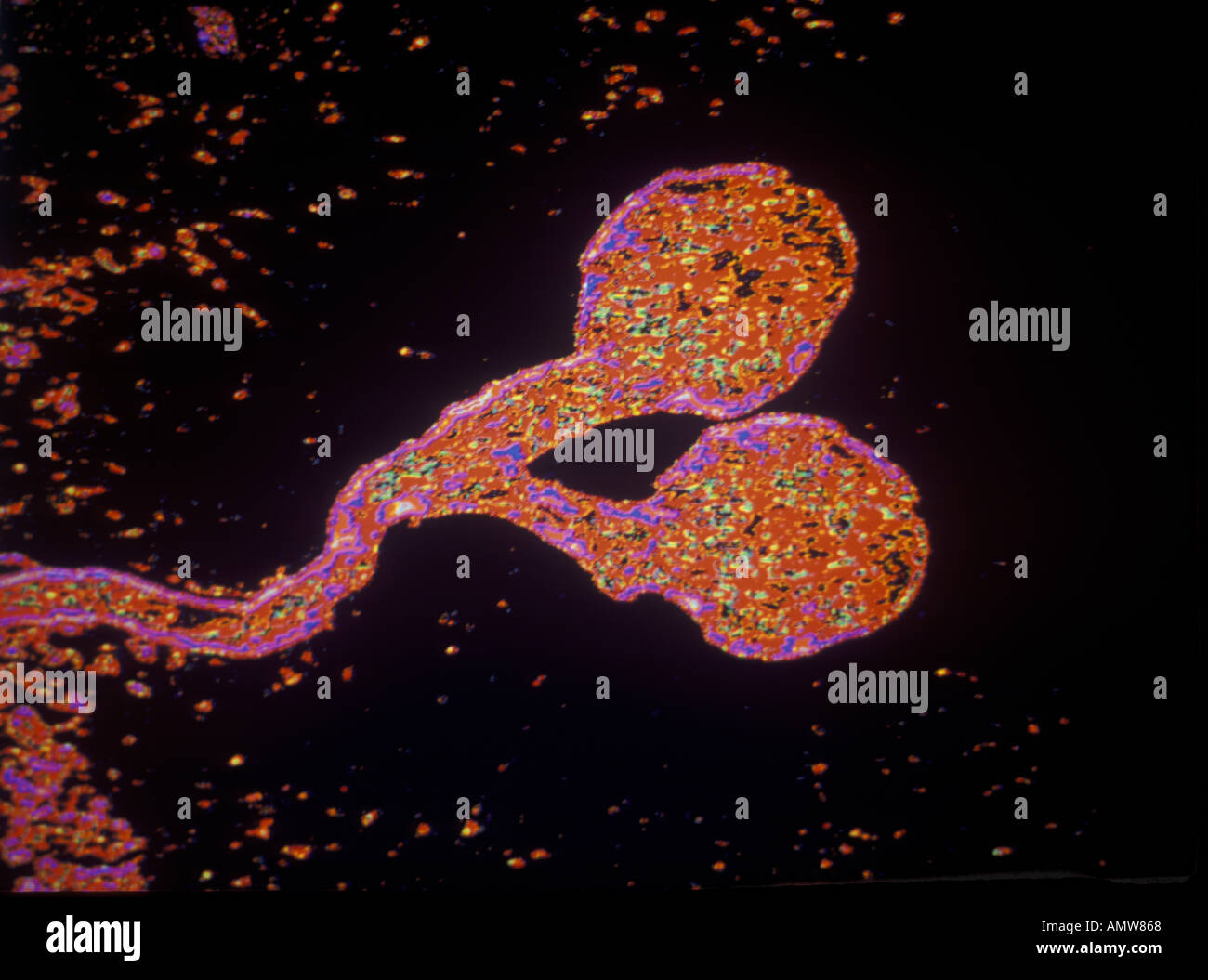 Defective sperm hi-res stock photography and images - Alamy