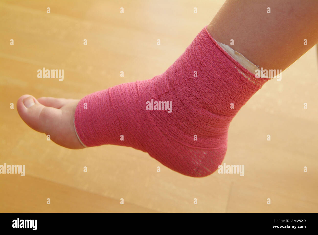 child with distorsion foot Stock Photo - Alamy