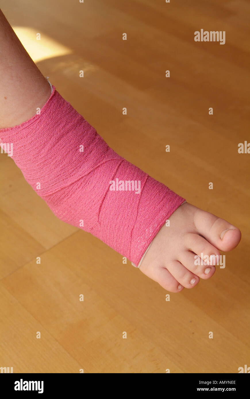 child with distorsion foot Stock Photo - Alamy