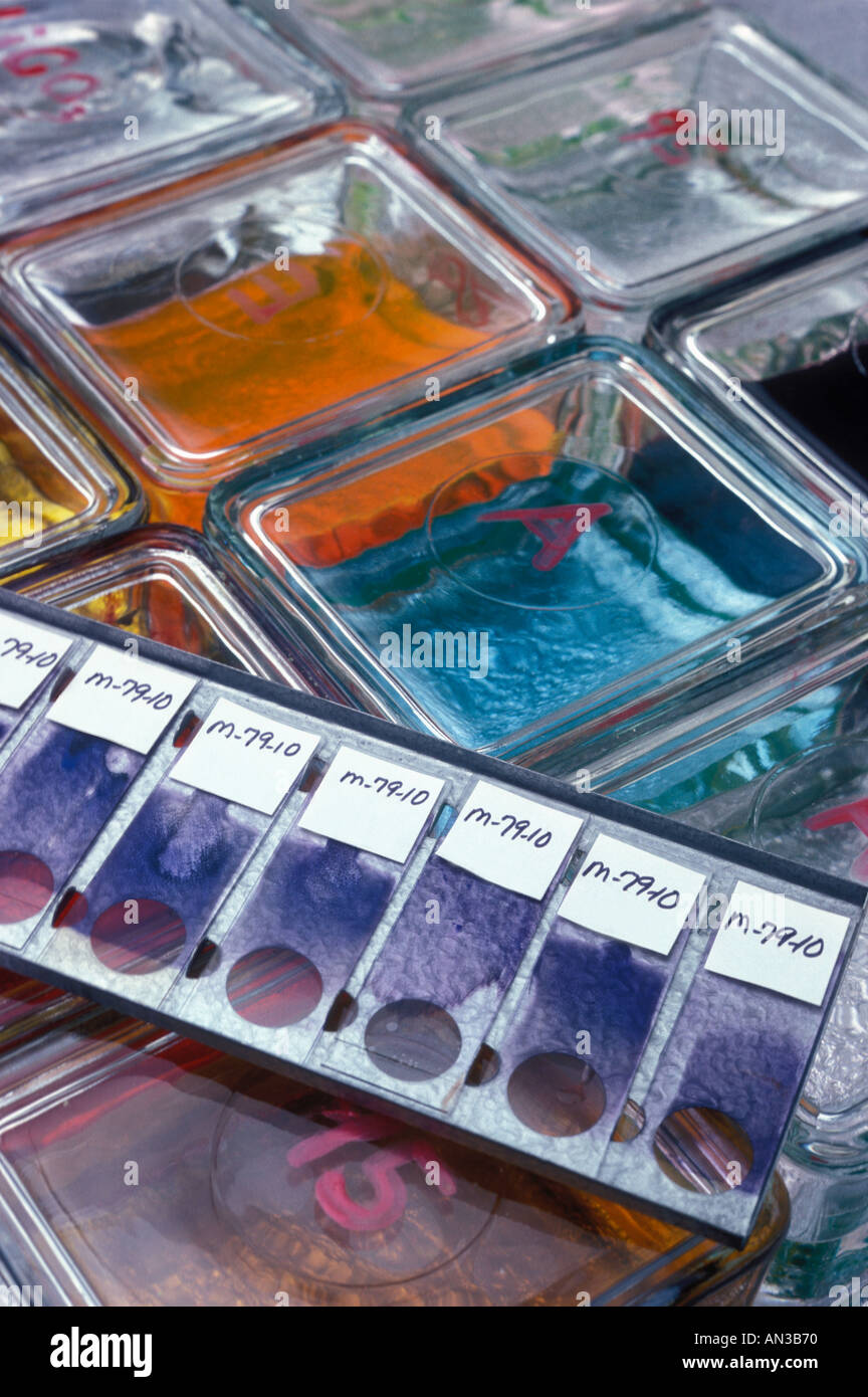 Still life specimen slides and indicator dyes in Medical testing ...