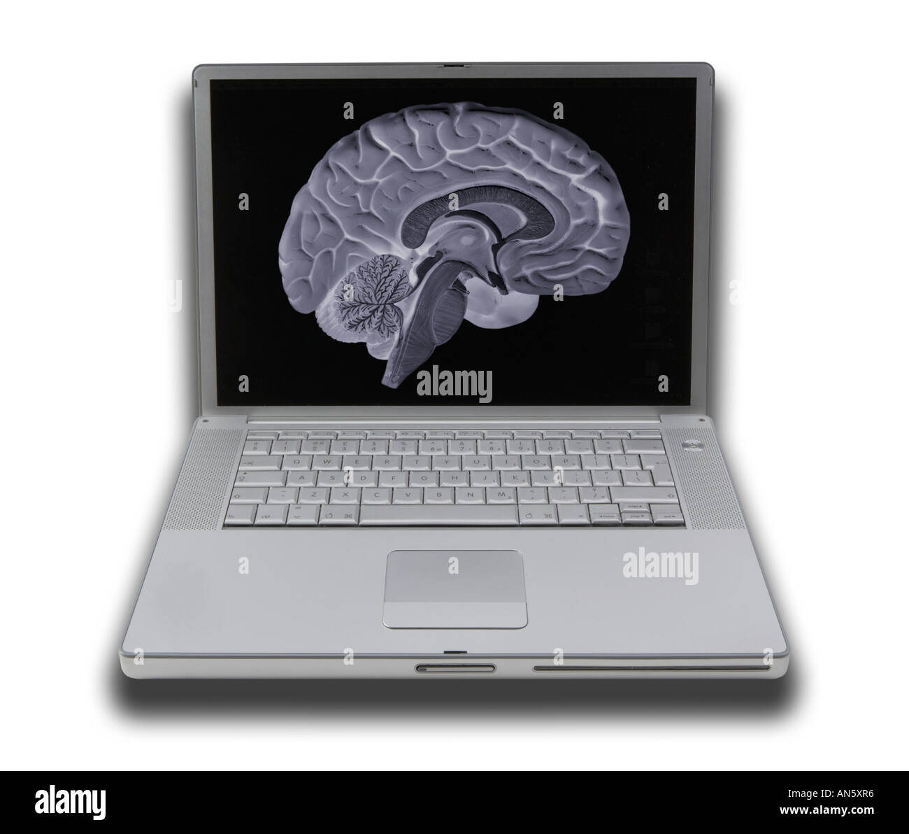 LAP TOP PORTABLE COMPUTER WITH SCREEN DISPLAYING PICTURE OF SLICE ...