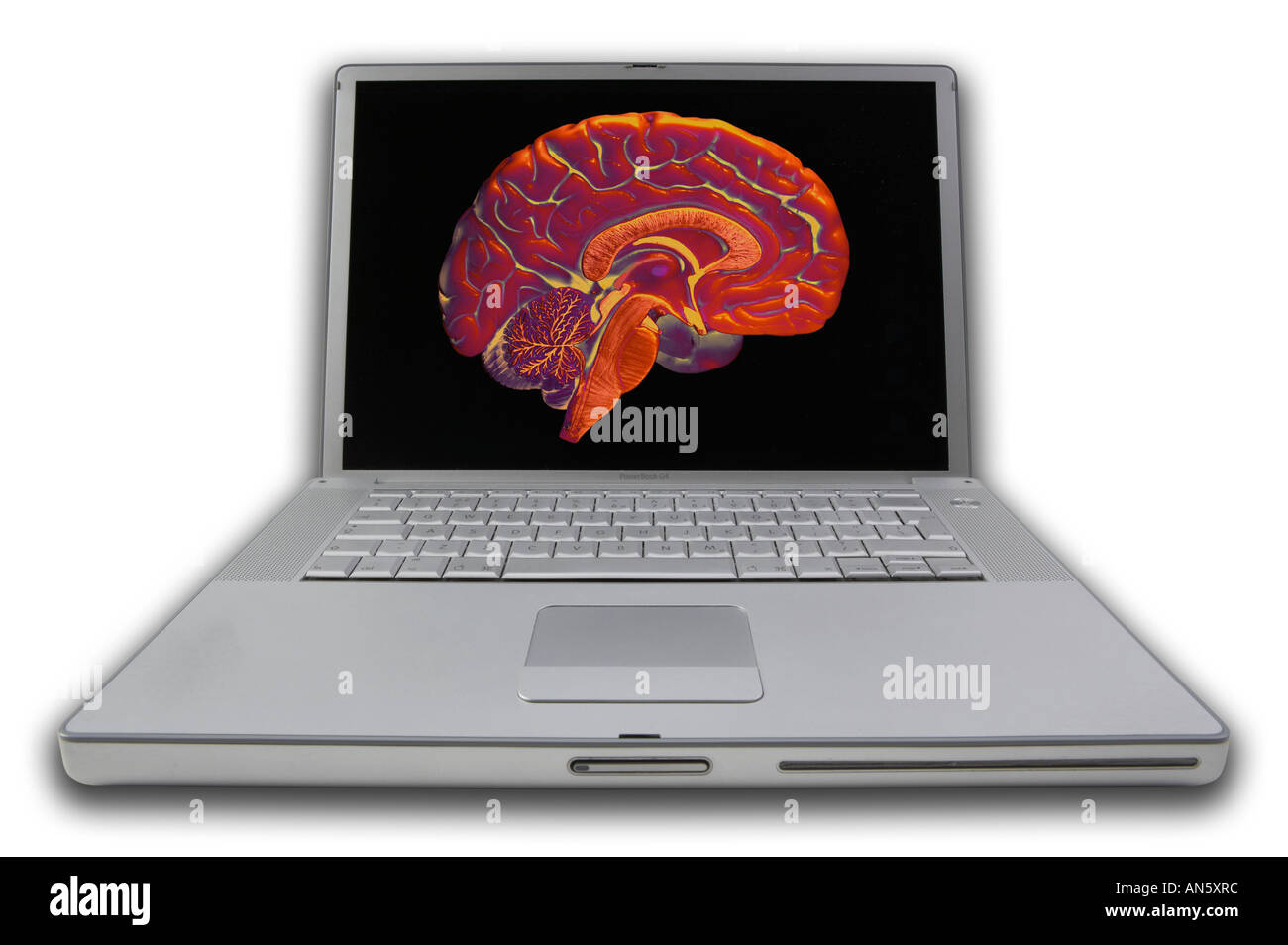 LAP TOP PORTABLE COMPUTER WITH SCREEN DISPLAYING FALSE COLOUR PICTURE ...