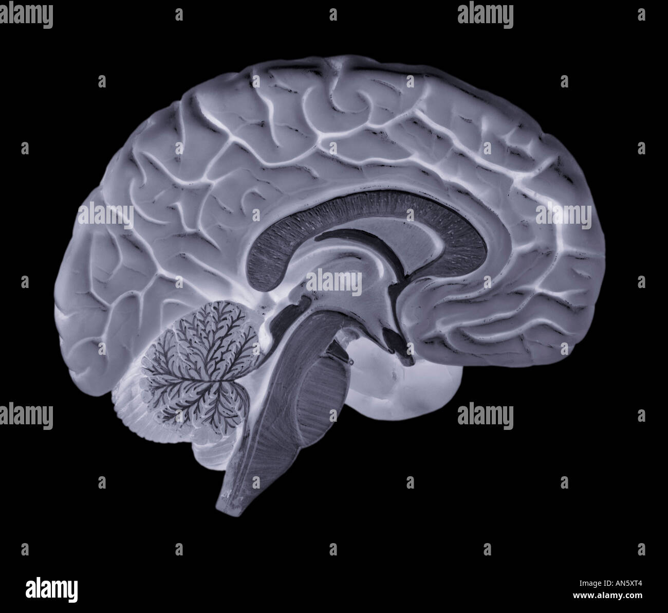 X RAY XRAY X-RAY IMAGE OF LEFT HALF OF HUMAN BRAIN Stock Photo - Alamy