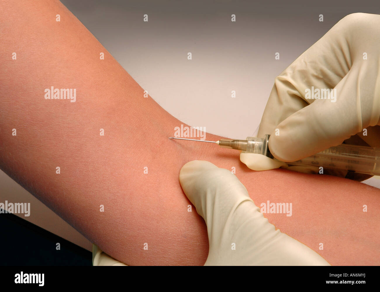 Hypodermic needle arm hi-res stock photography and images - Alamy