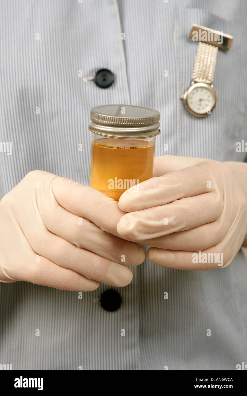 nurse wearing blue uniform holding a specimen jar of urine Stock Photo ...