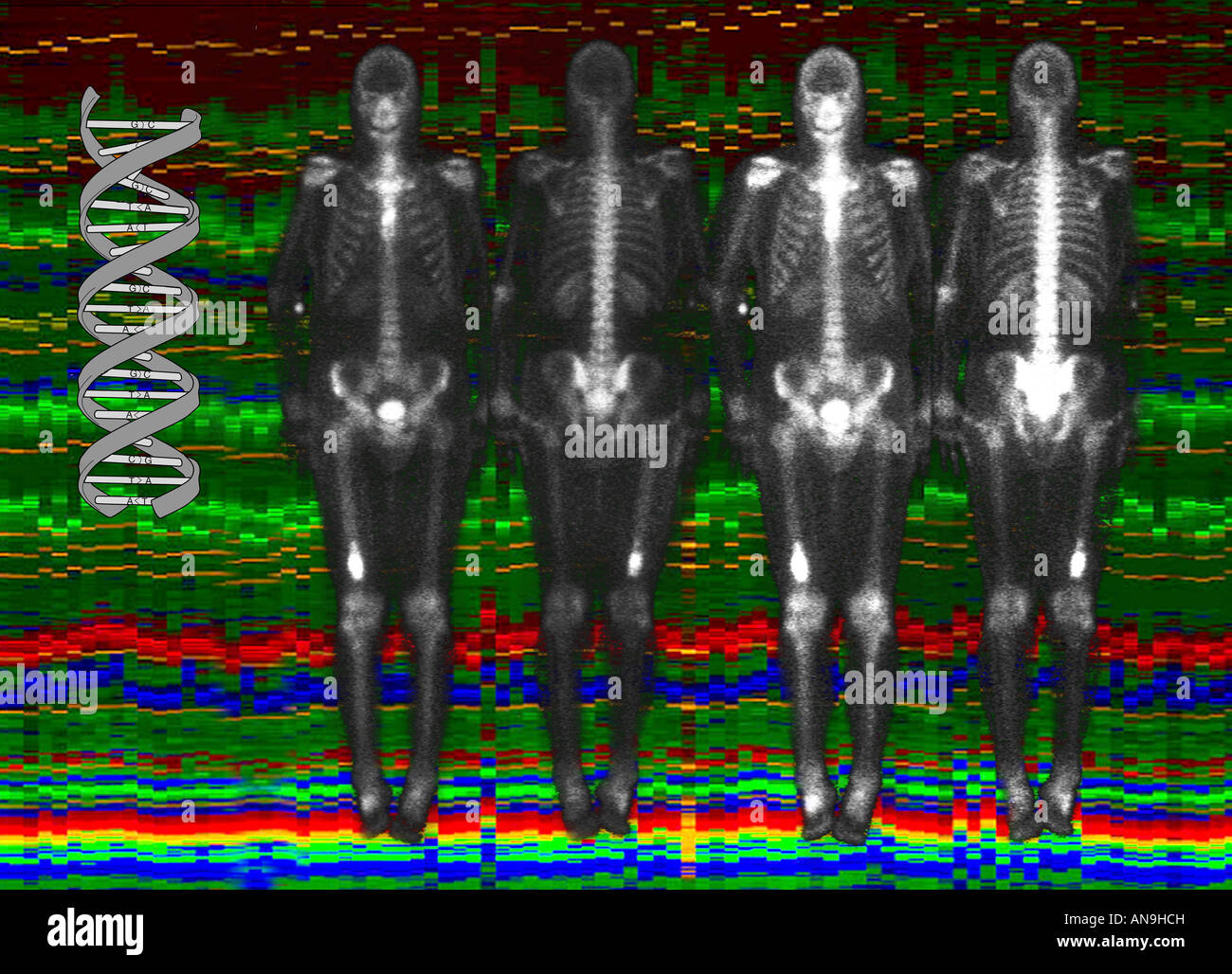 X-rays with DNA chart Stock Photo - Alamy