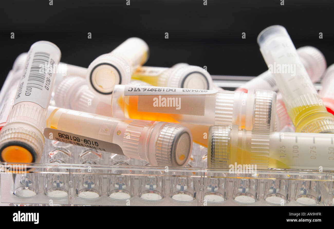 Test Tubes Holding Human DNA Samples Stock Photo - Alamy