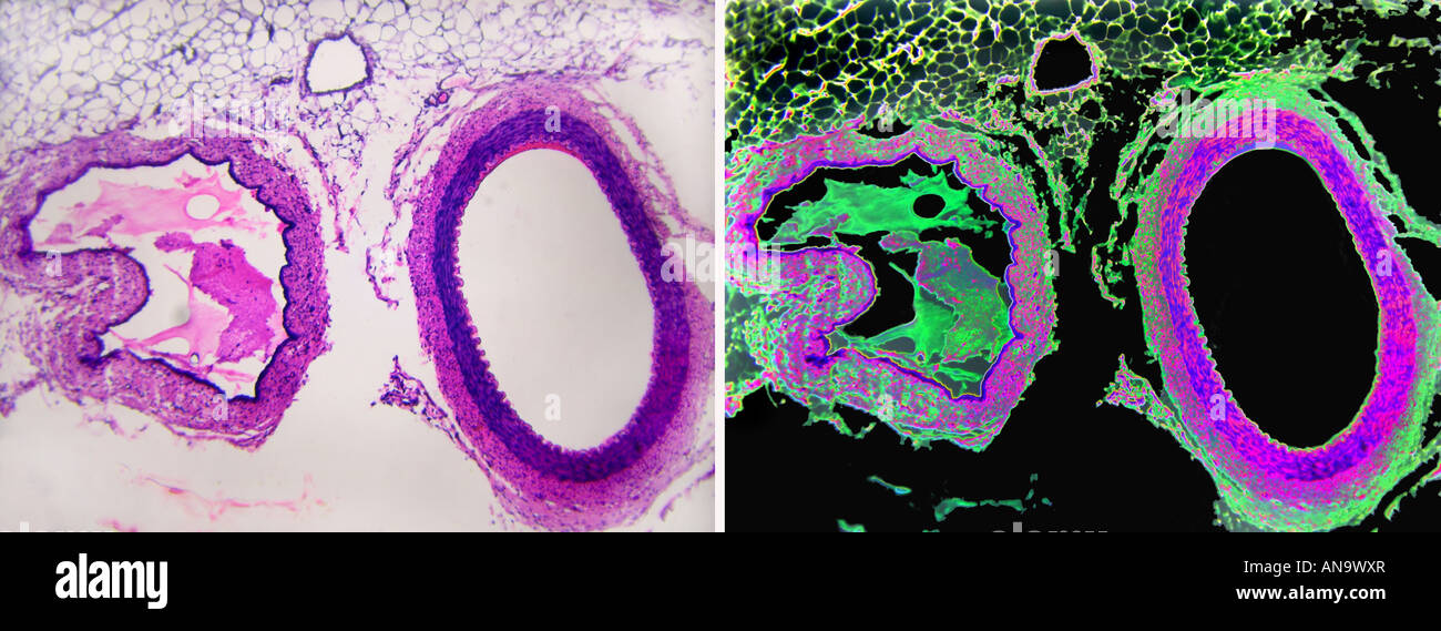 Vein cross section hi-res stock photography and images - Alamy