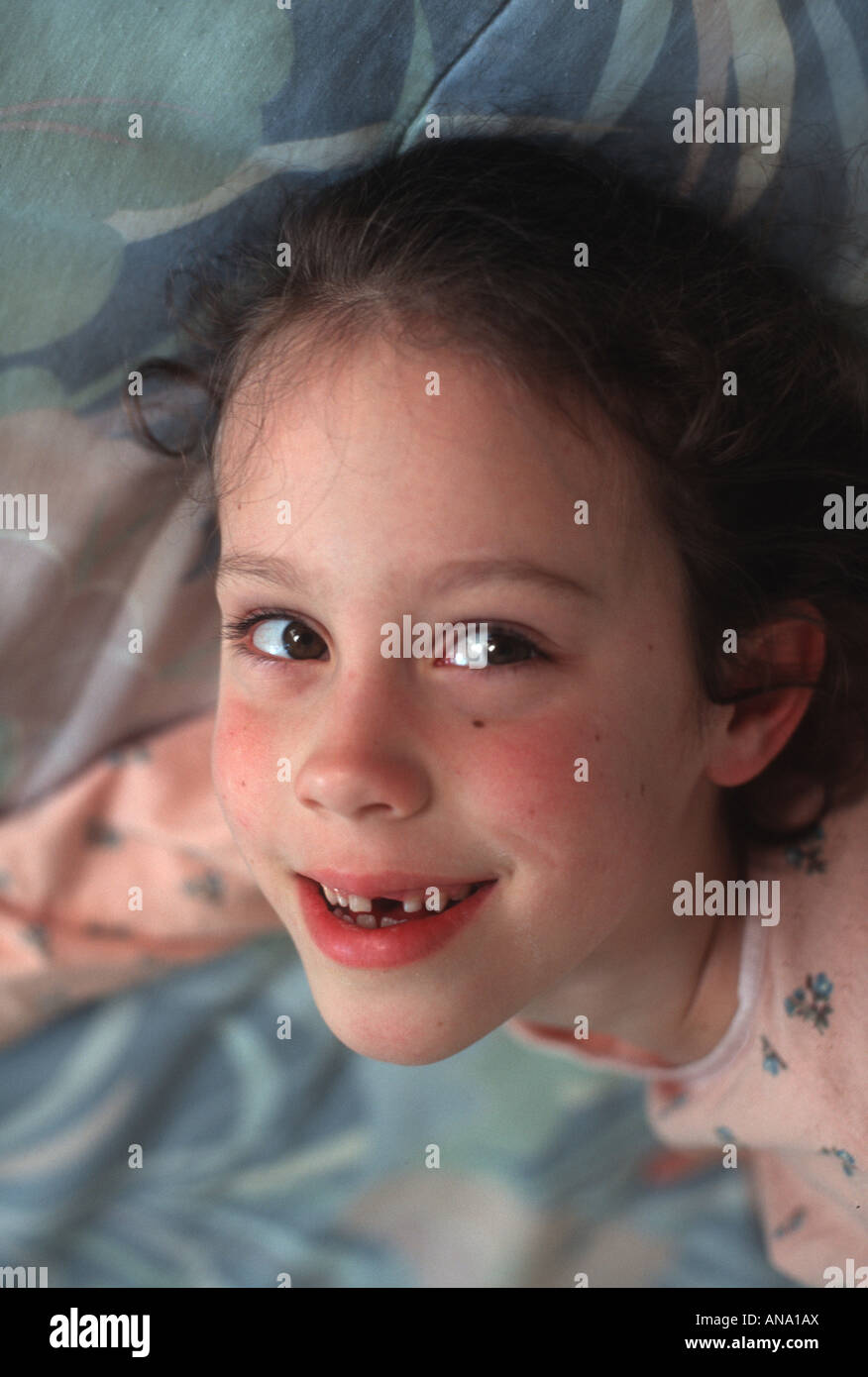 Child with missing front tooth Stock Photo - Alamy