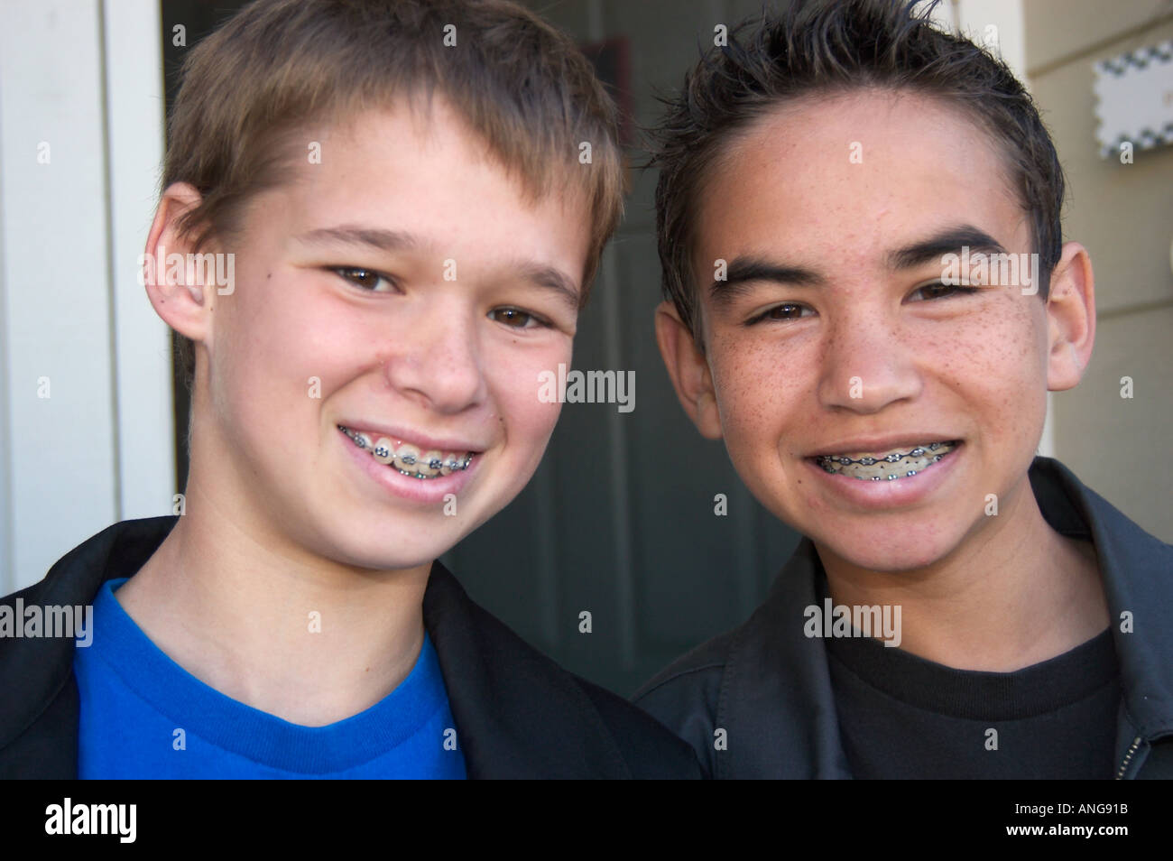 boys with braces Stock Photo - Alamy
