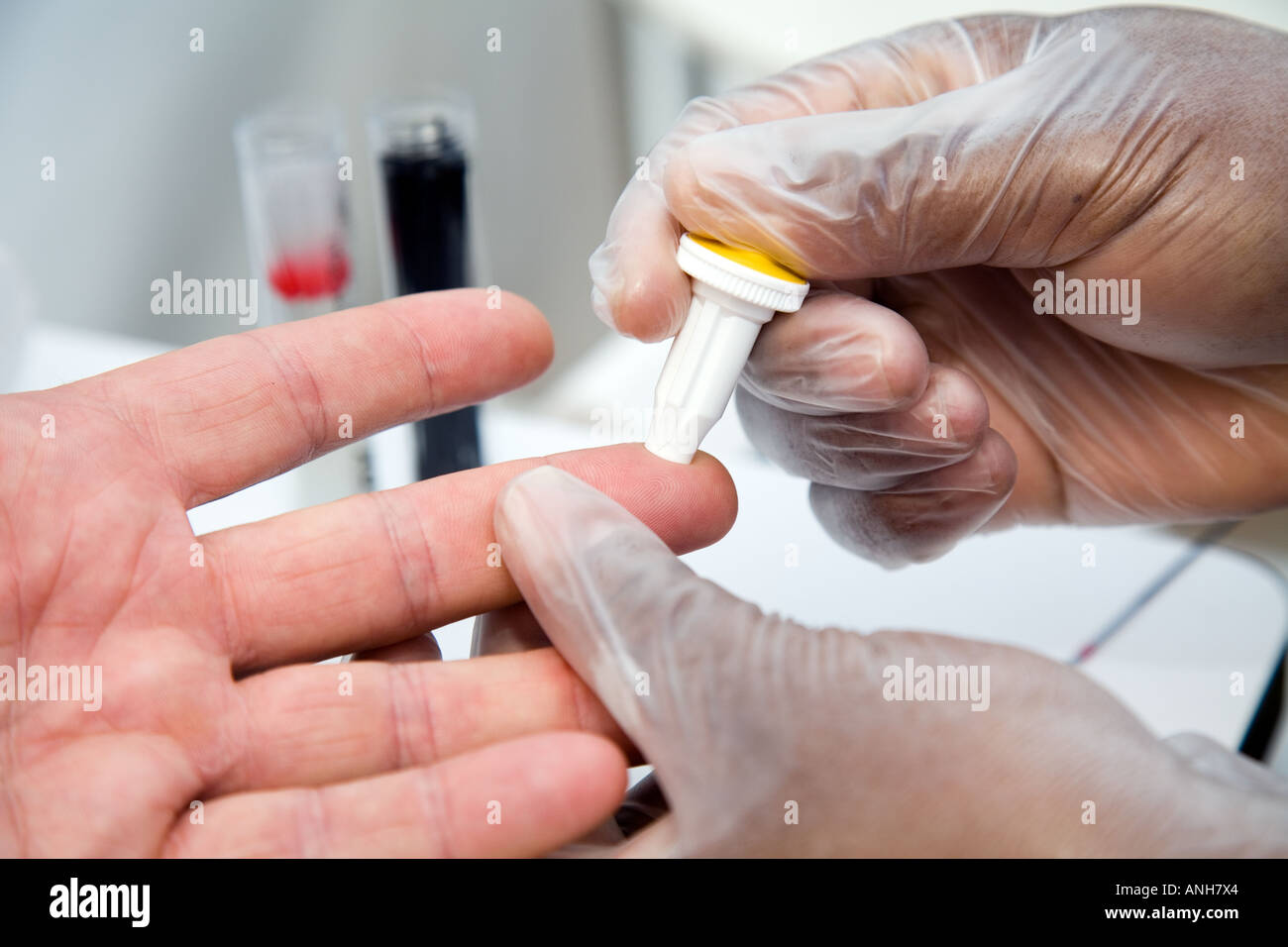 Cholesterol screen testing via blood test Stock Photo - Alamy