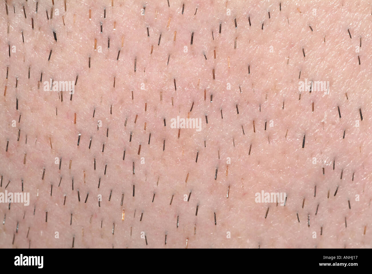 Skin mans face stubble hi-res stock photography and images - Alamy