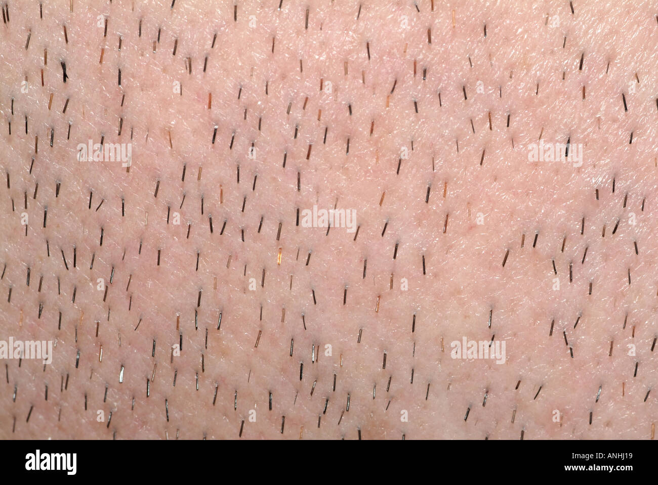 Stubble Skin on an Unshaven Male Face, Close Up Stock Photo - Alamy